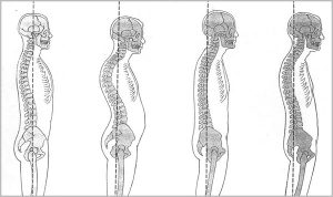 Postural Assessment Chart